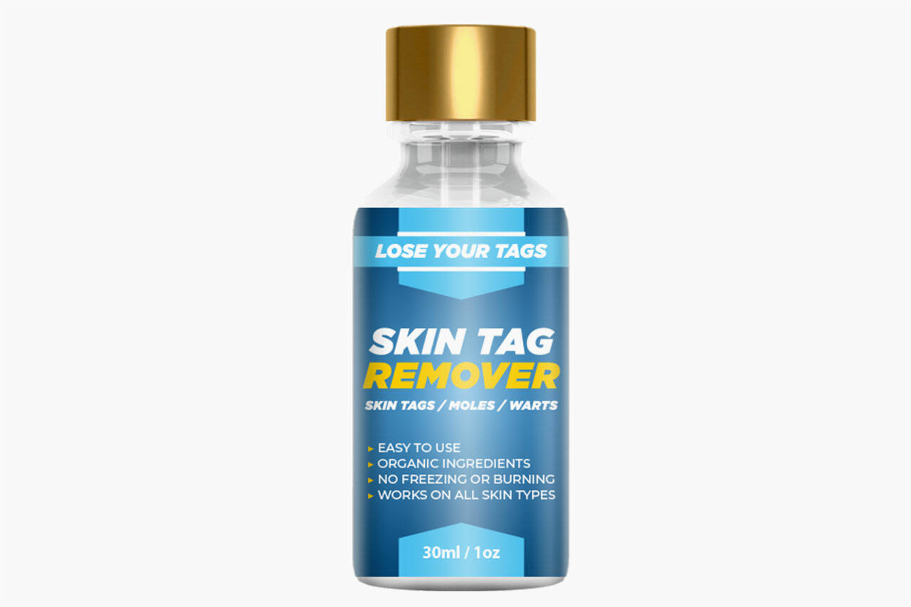 Lose Your Tags Skin Tag Remover Reviewed - Scam or Legit? | Tacoma ...